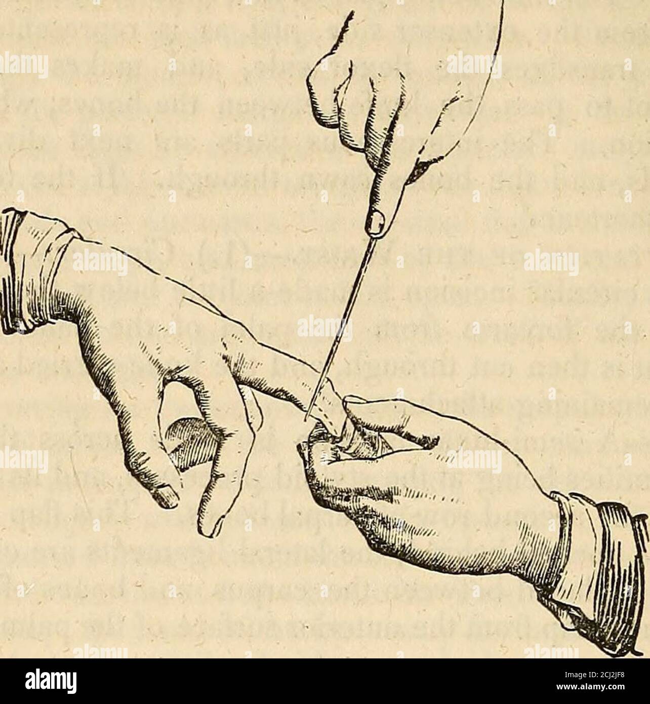 Phalan hi-res stock photography and images - Alamy