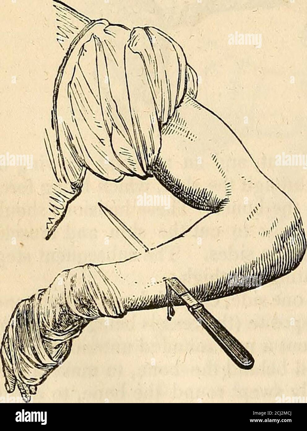 . The principles and practice of modern surgery . gh the muscles in ...