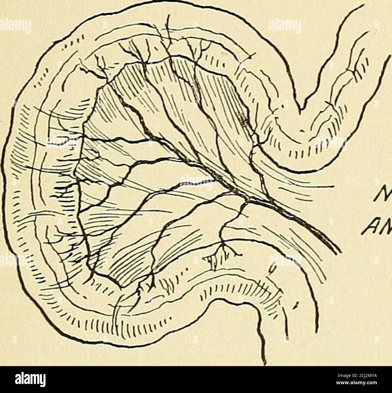 Distal intestine hi-res stock photography and images - Alamy