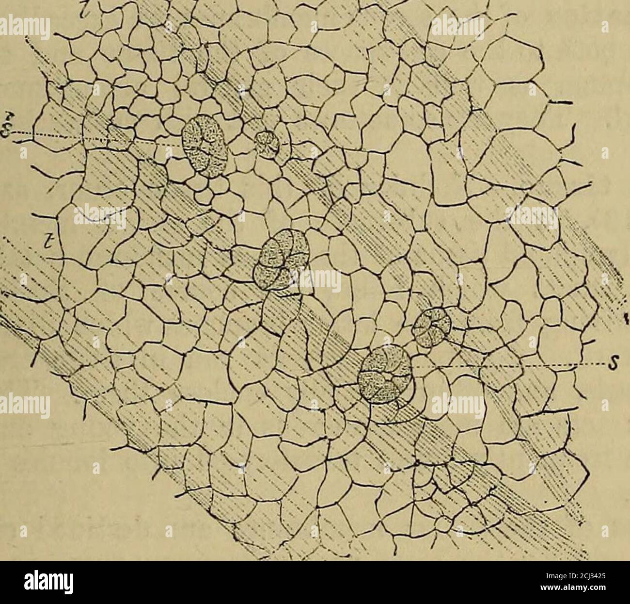Cisterna Magna Anatomy