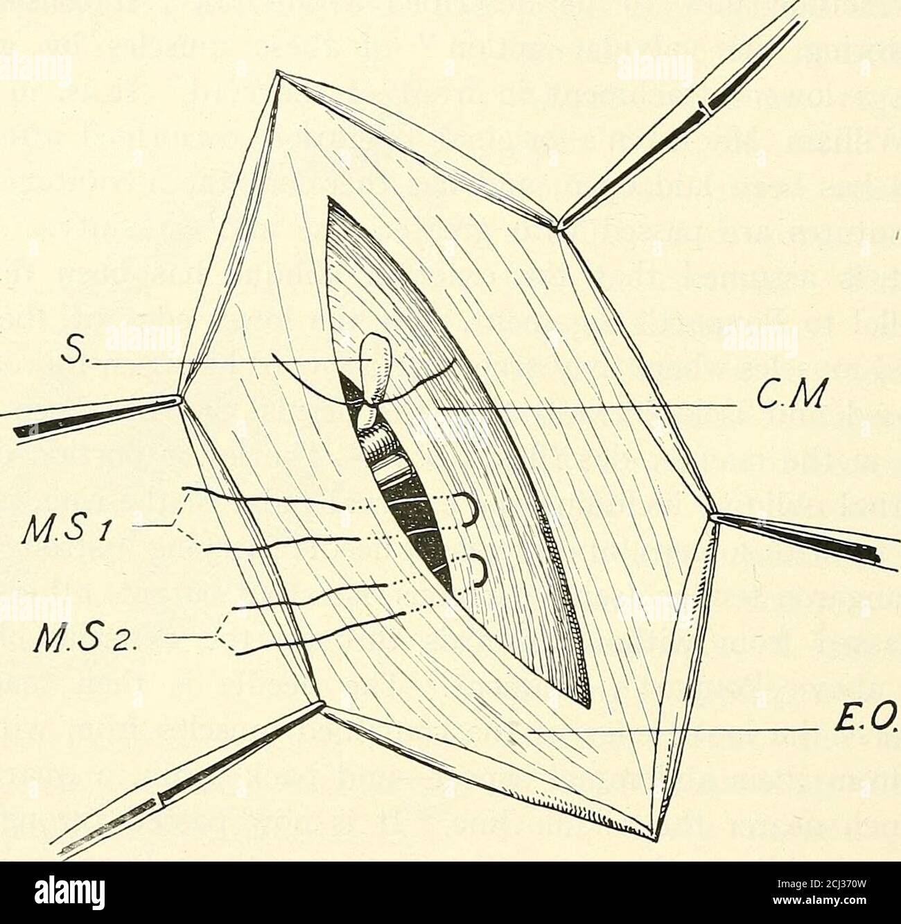 . A manual of operative surgery . external oblique the same distance ...