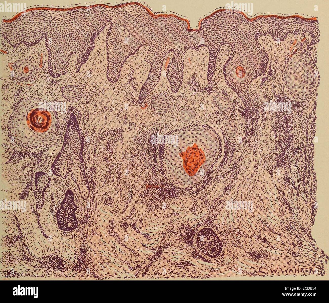 Bartholin glands hi-res stock photography and images - Alamy
