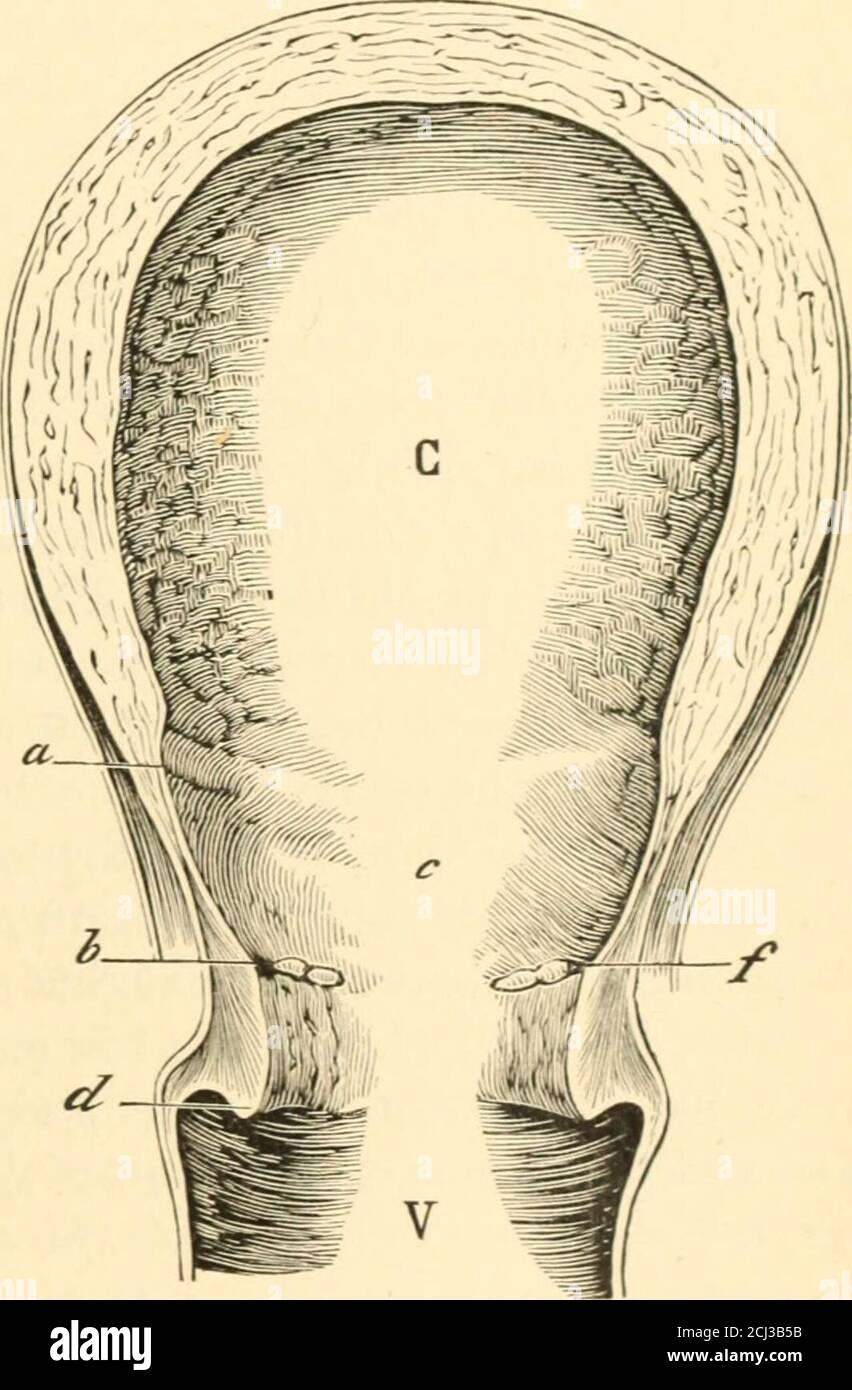 Cervix labor hi-res stock photography and images - Alamy