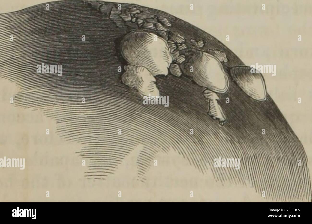 Bones of the calvarium hi-res stock photography and images - Alamy