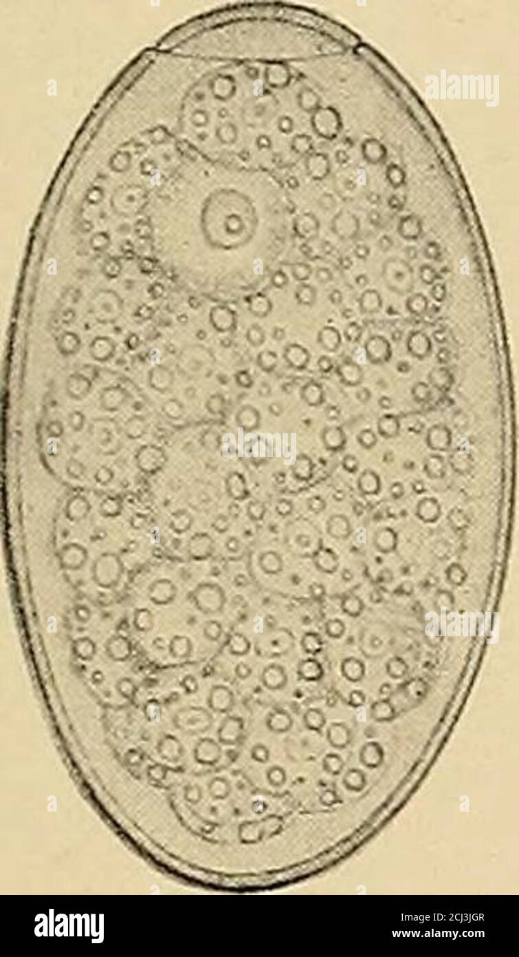 . Physical diagnosis . Fasciola hepatica Stock Photo - Alamy