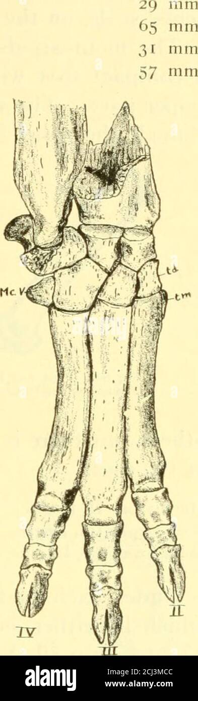 Styloid process of ulna hi-res stock photography and images - Alamy