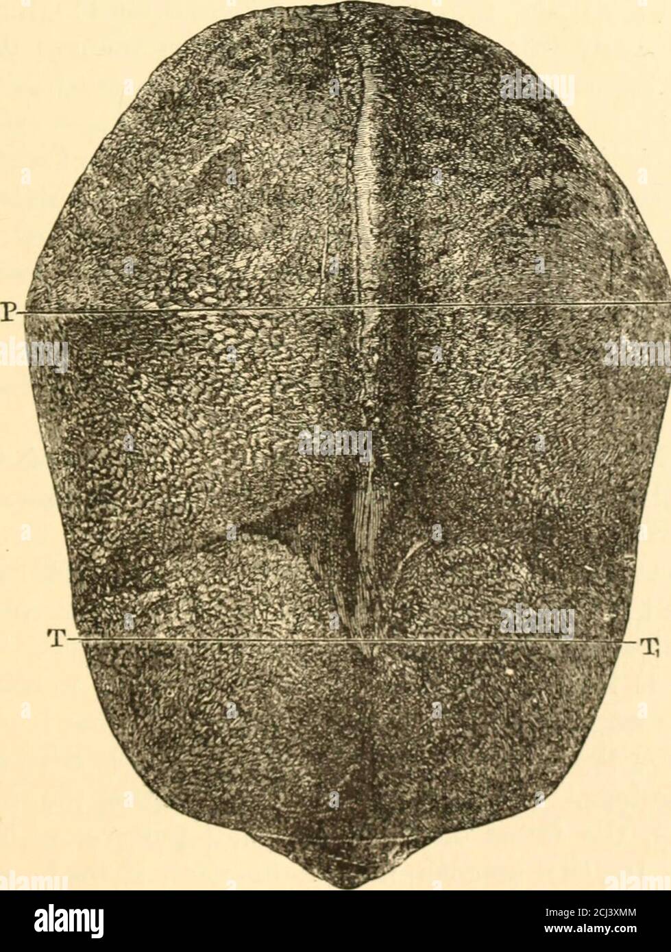 Fetal skull hi-res stock photography and images - Alamy