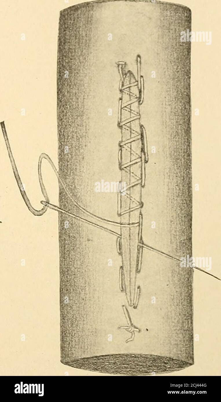 . American practice of surgery ; a complete system of the science and ...
