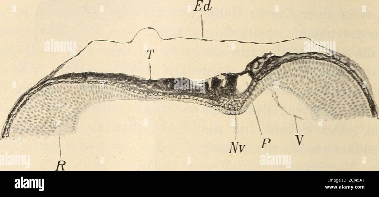 Capsula lentis hi-res stock photography and images - Alamy