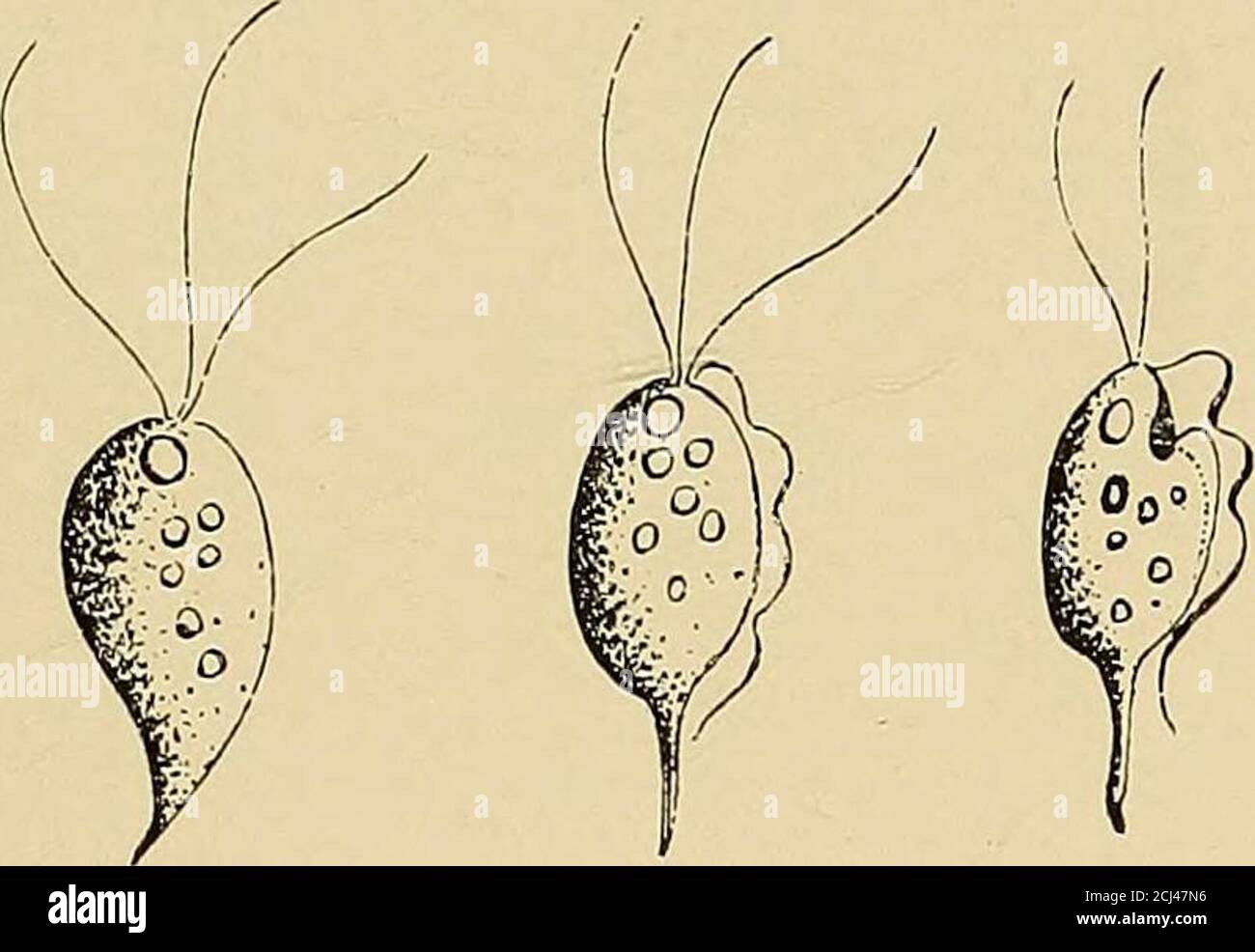 Appendix abscess hi-res stock photography and images - Alamy