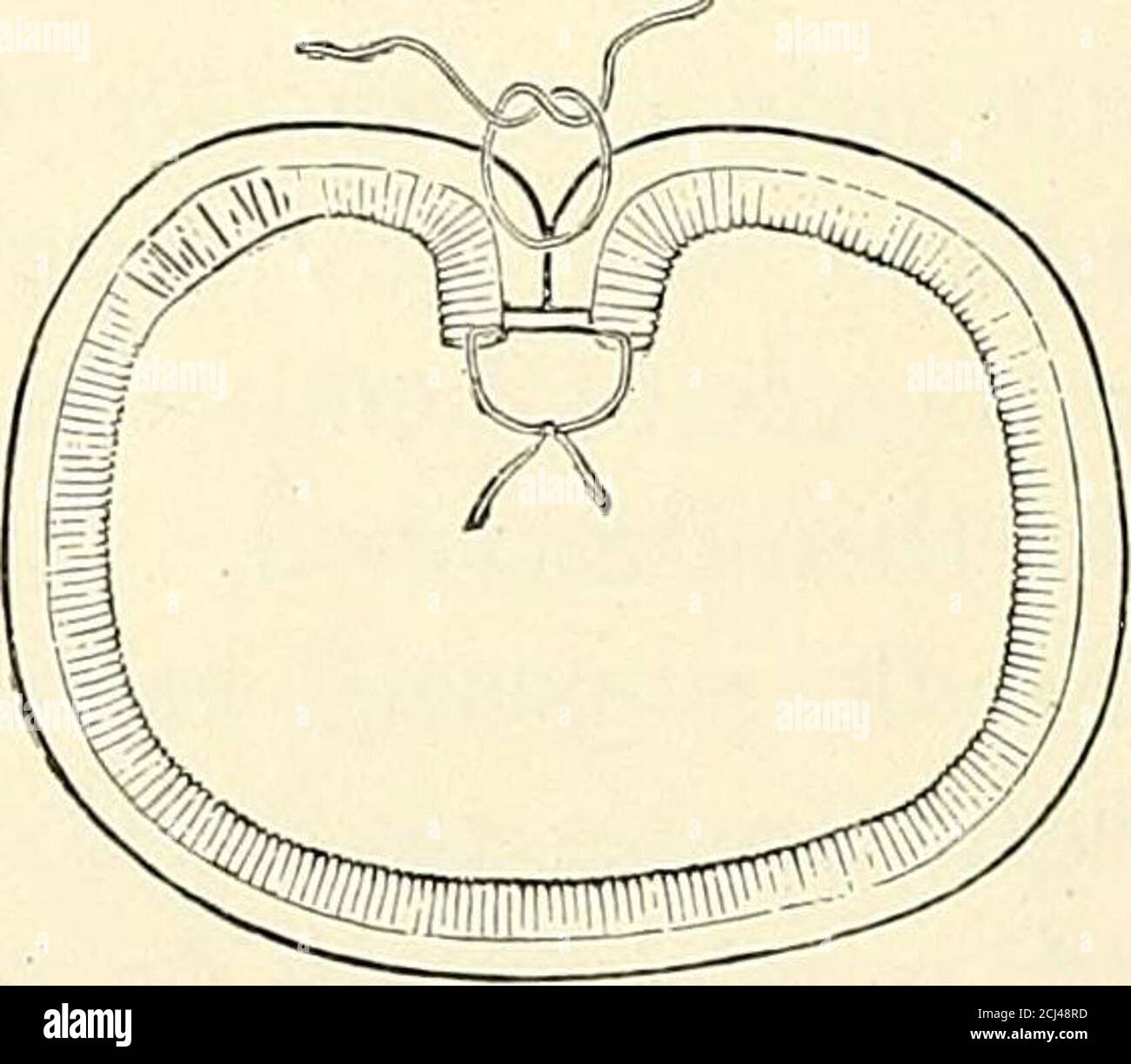 . A manual of operative surgery . FIG. 74. —LEMBERTS SUTURE. FIG. 75 ...