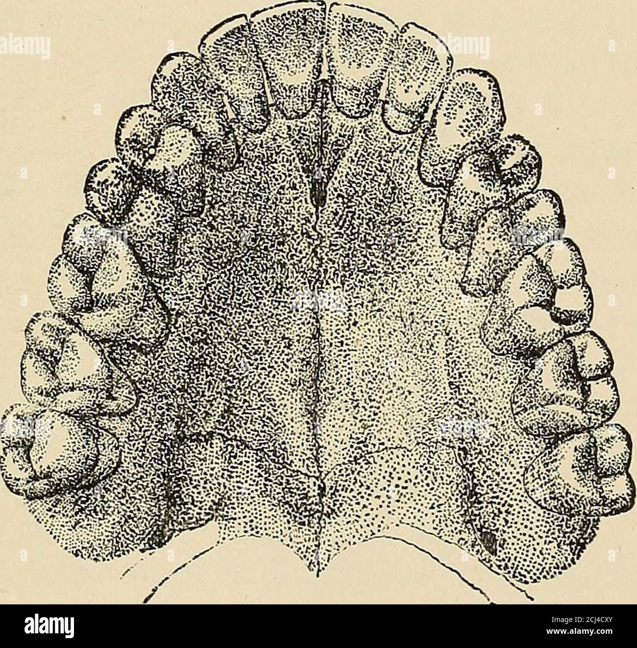 Alveolar bones hi-res stock photography and images - Alamy