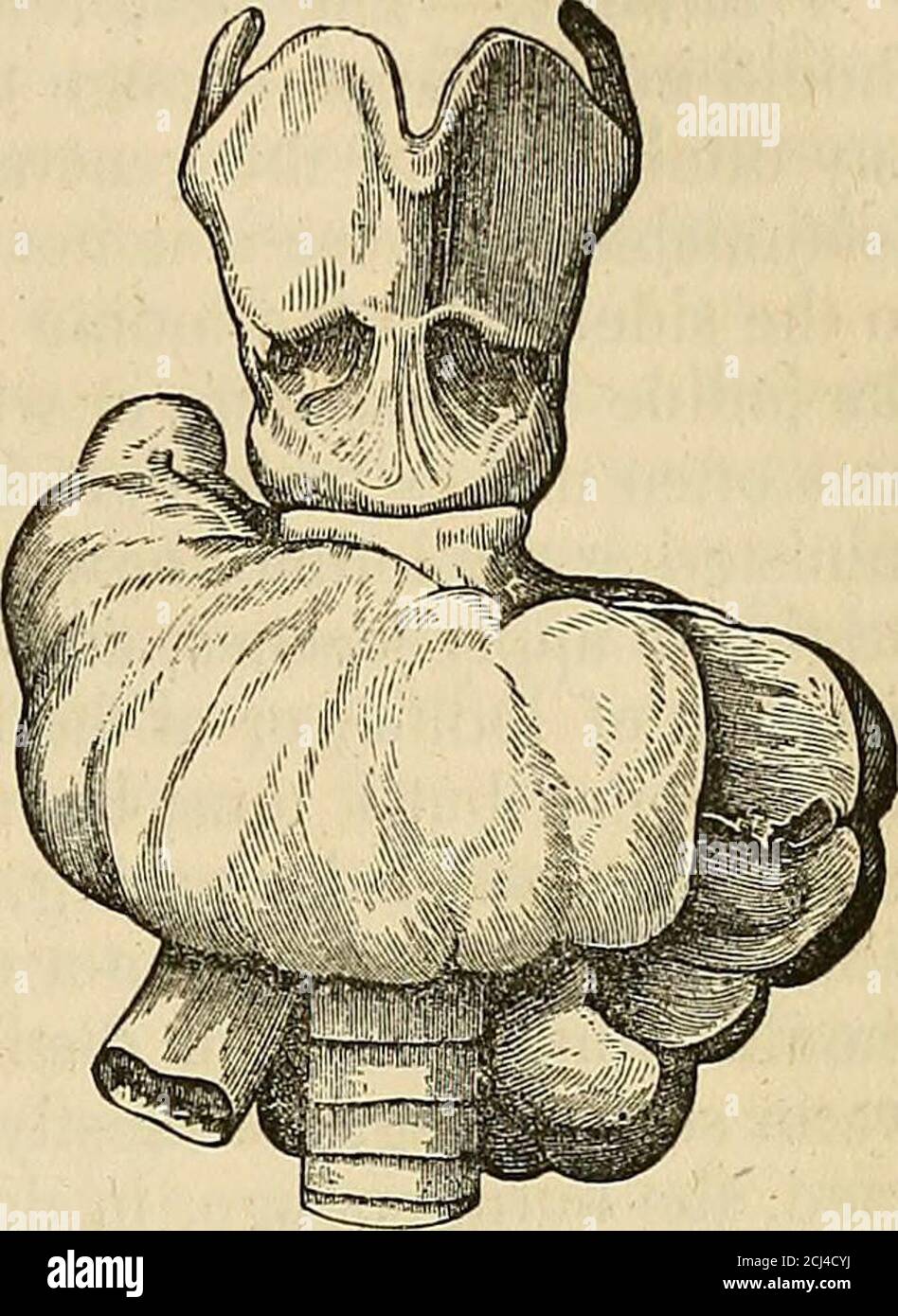 . The principles and practice of modern surgery . o promote the ...