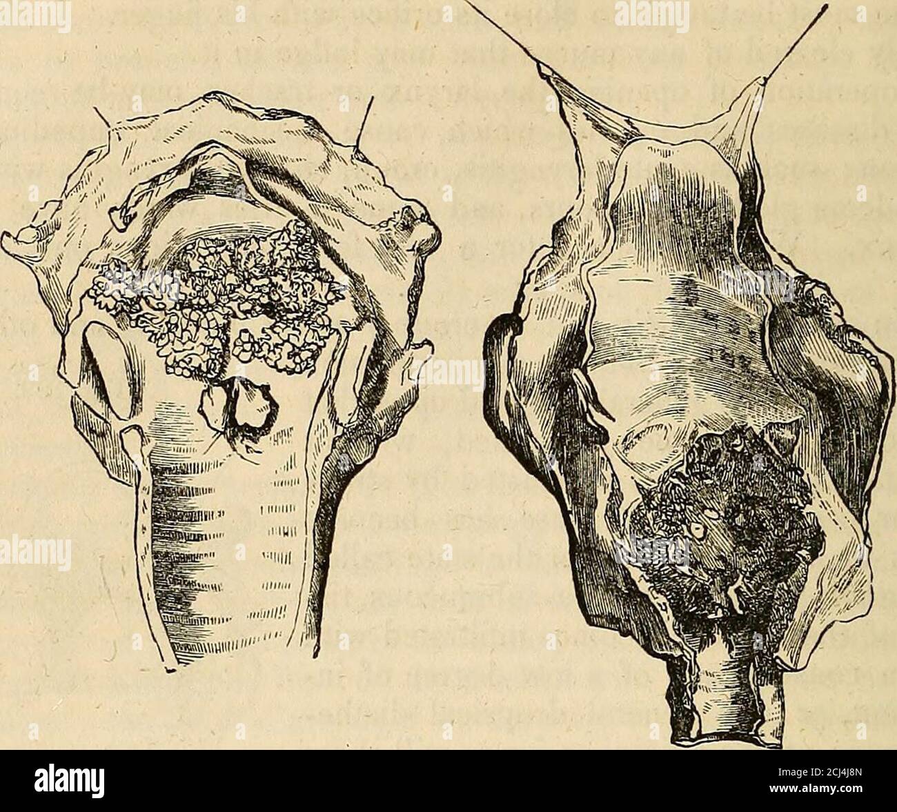 Polypous High Resolution Stock Photography and Images - Alamy