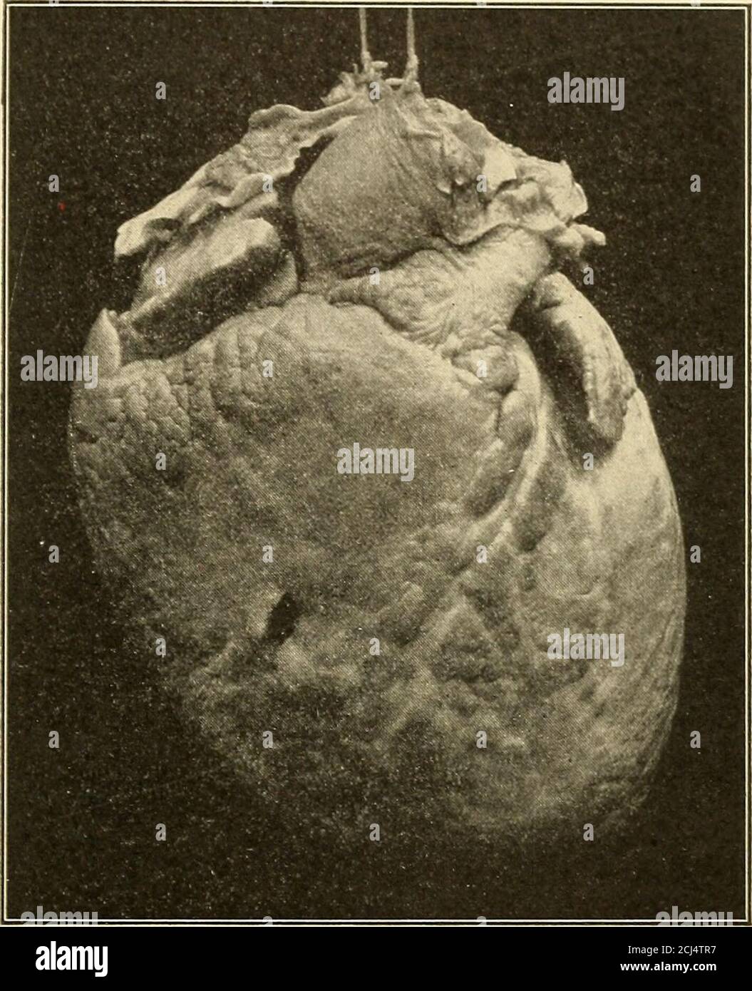 . American practice of surgery ; a complete system of the science and ...