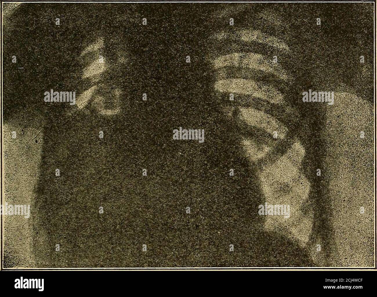 . Physical diagnosis . great majority of cases pneumothorax is ...