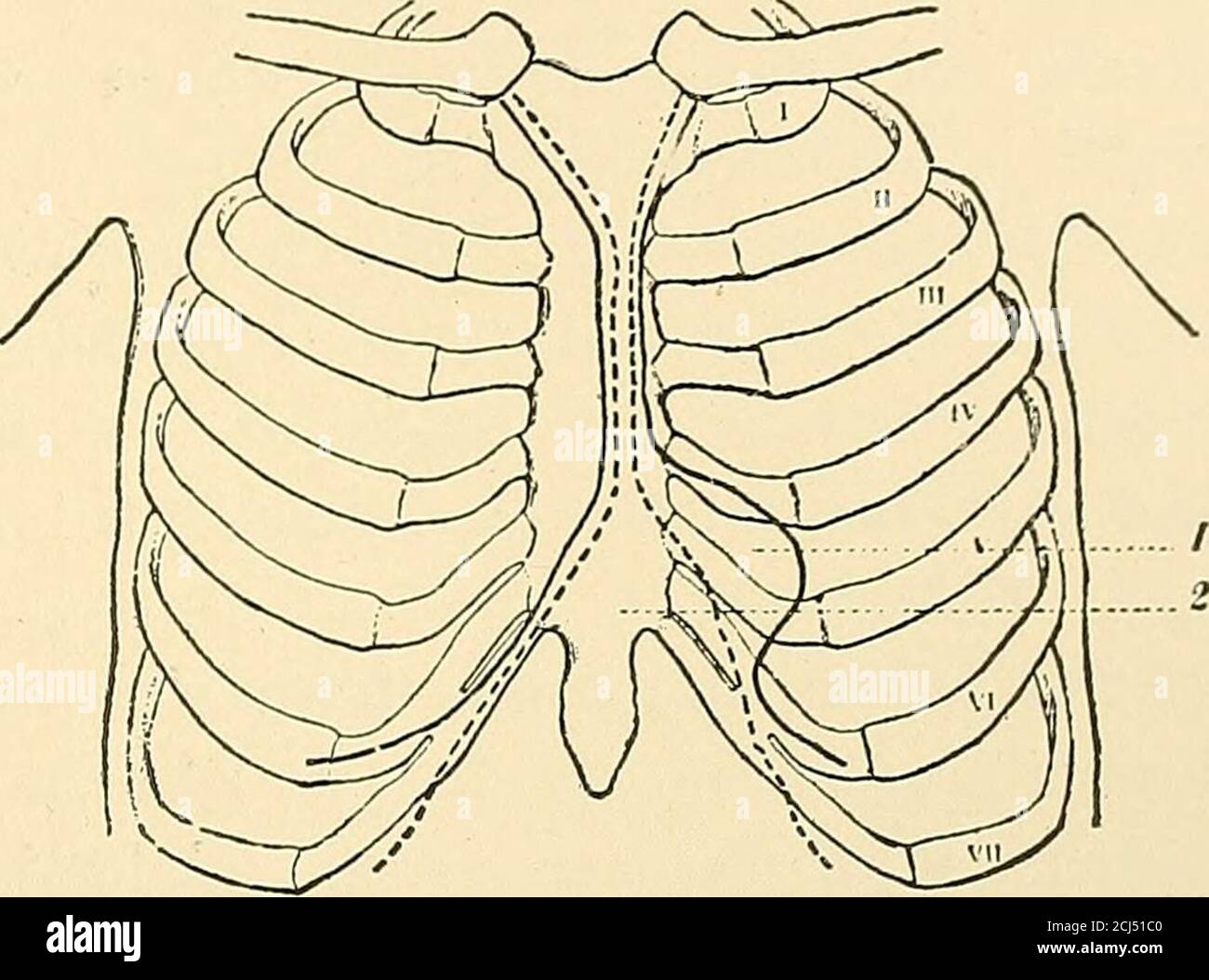 . American practice of surgery ; a complete system of the science and ...