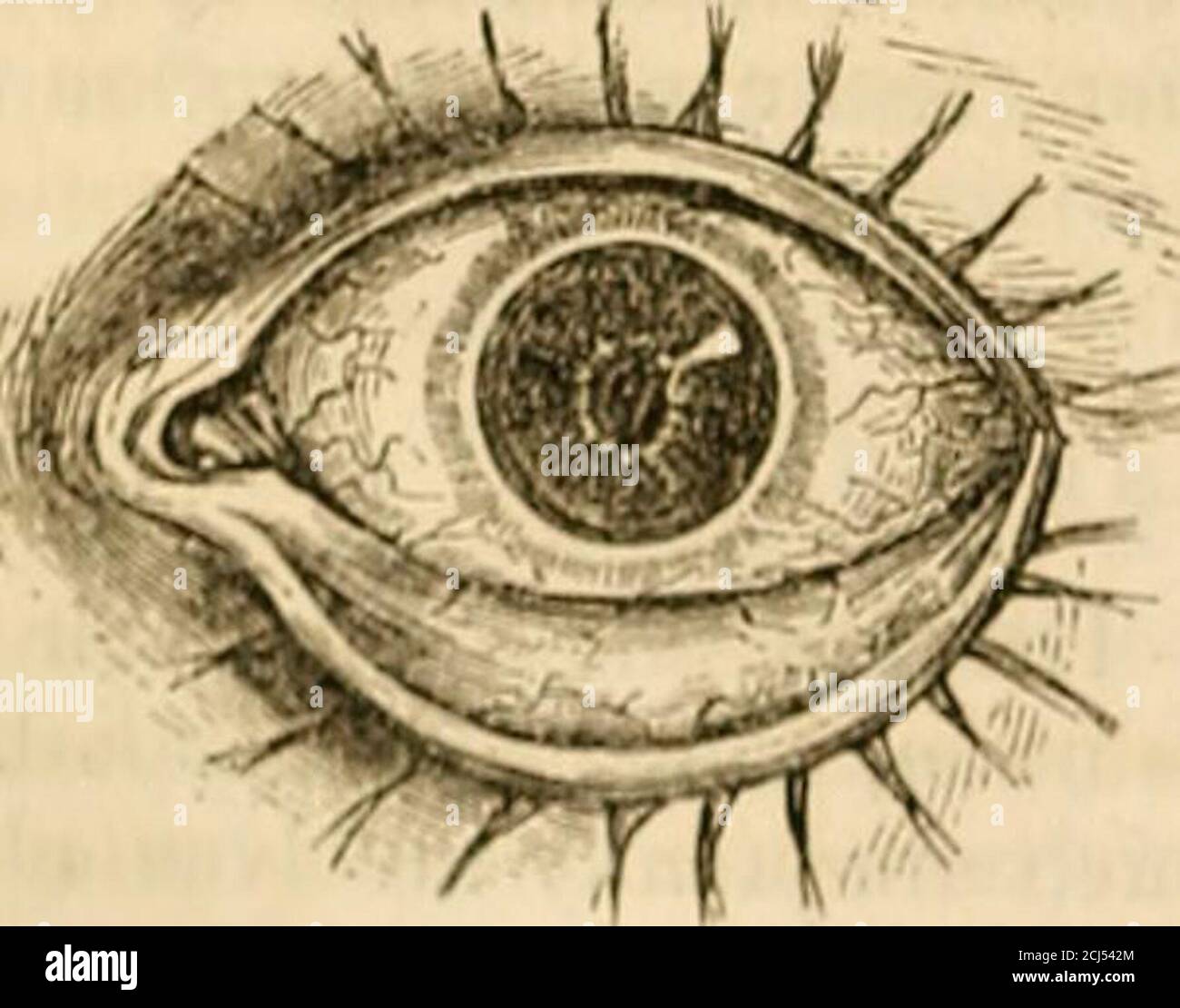 Lymph nodules hi-res stock photography and images - Alamy