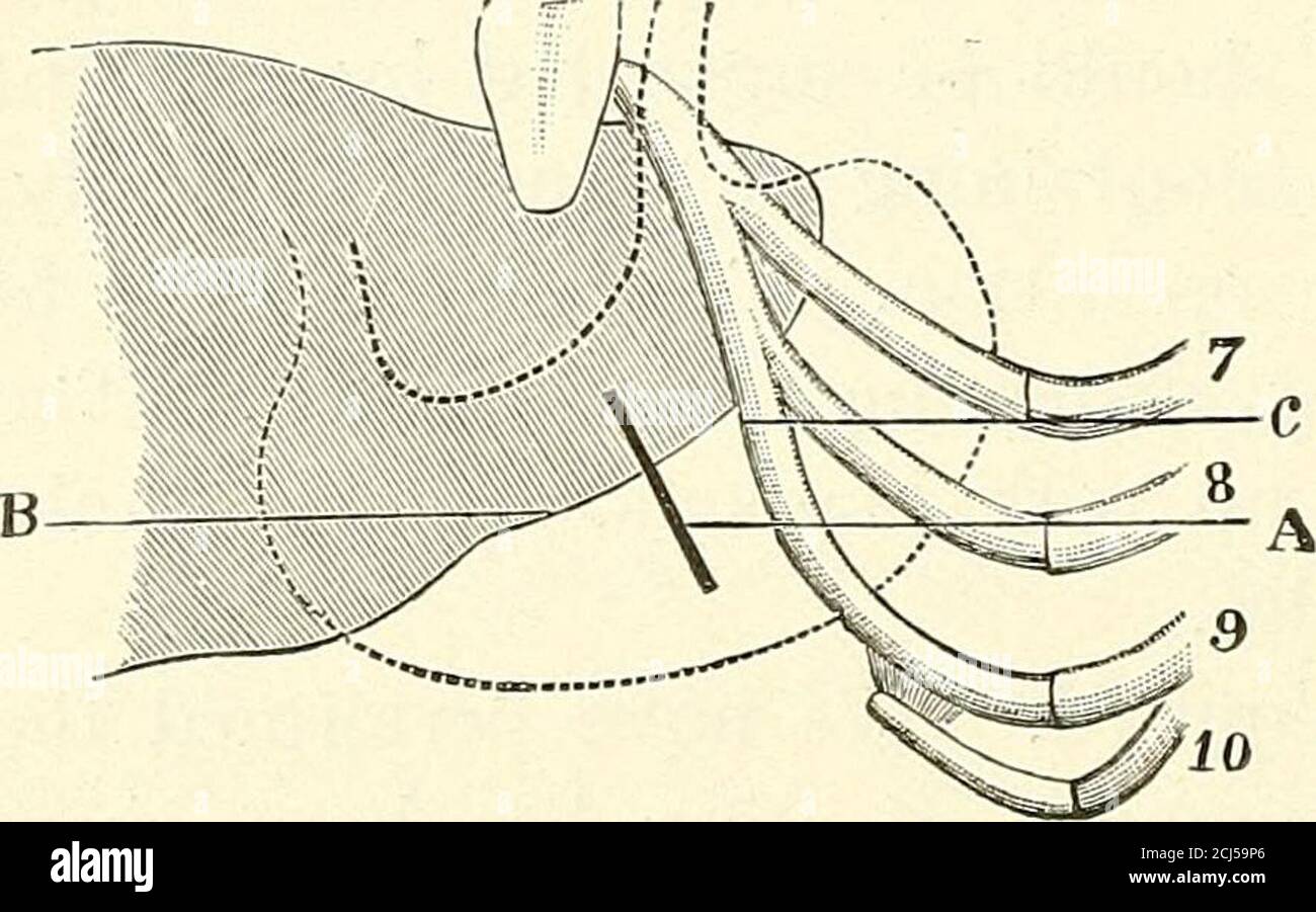 Epigastrium hi-res stock photography and images - Alamy