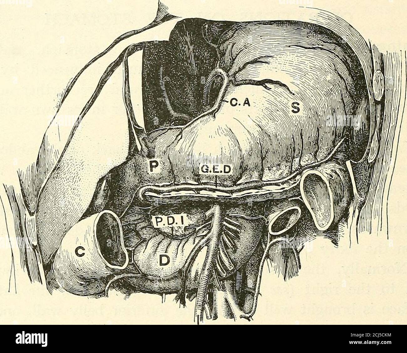 . A manual of operative surgery . e dilated stomach maynearly fill the ...