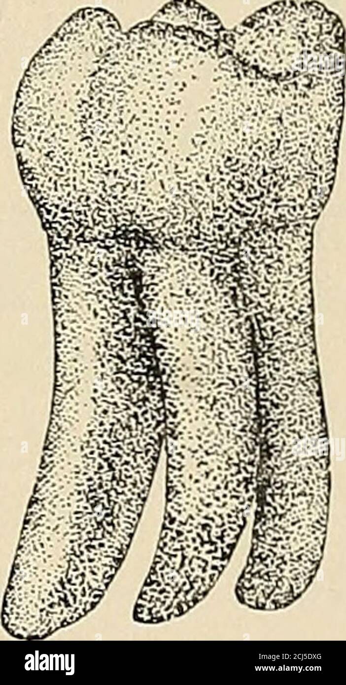 Molar groove hi-res stock photography and images - Alamy