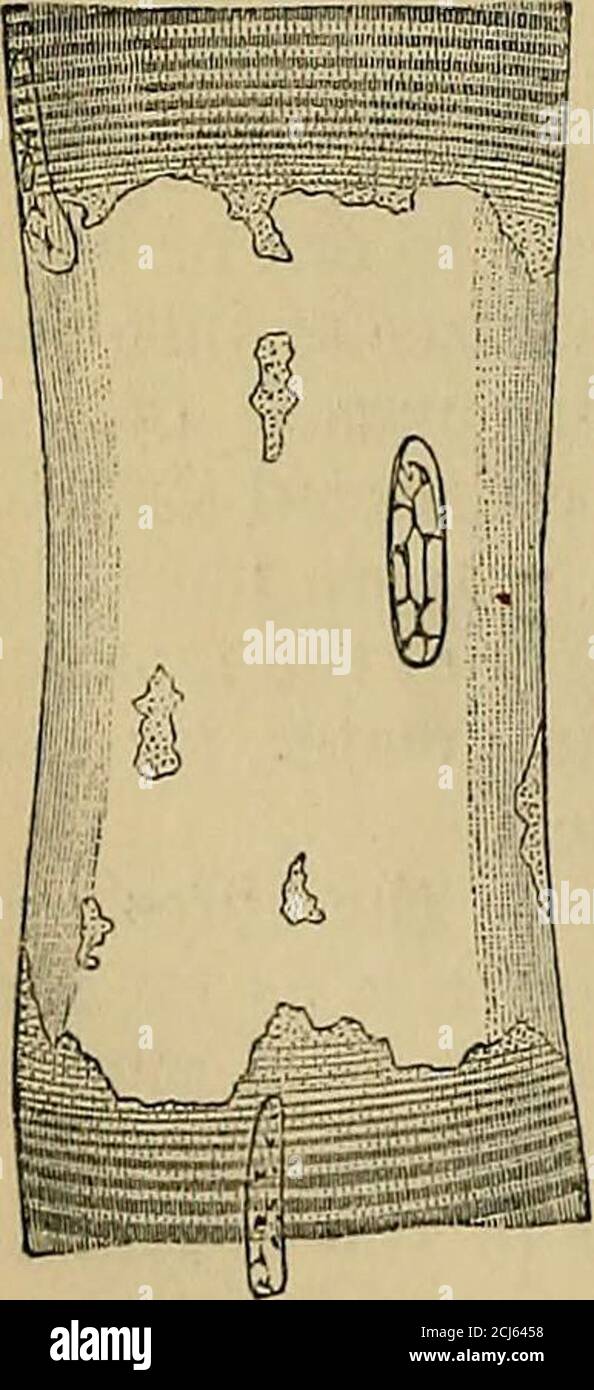 . Quain's elements of anatomy . Fiff. no. Fisj. 116.. -Sarcolemma of ...