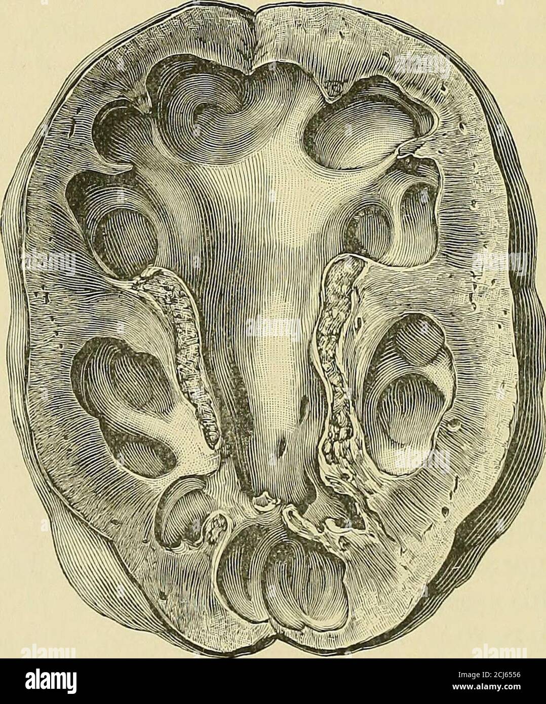 . On the origin and progress of renal surgery, with special reference ...