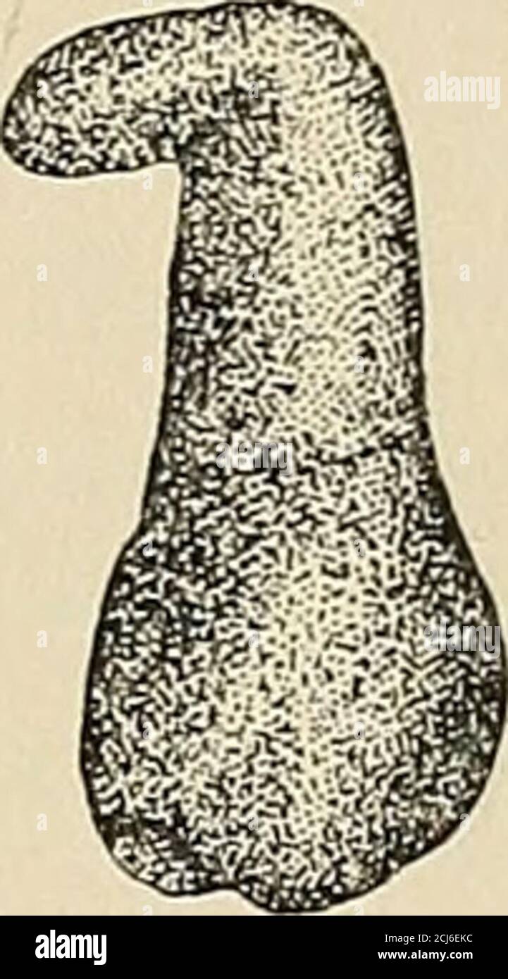 Occlusal surface hi-res stock photography and images - Alamy
