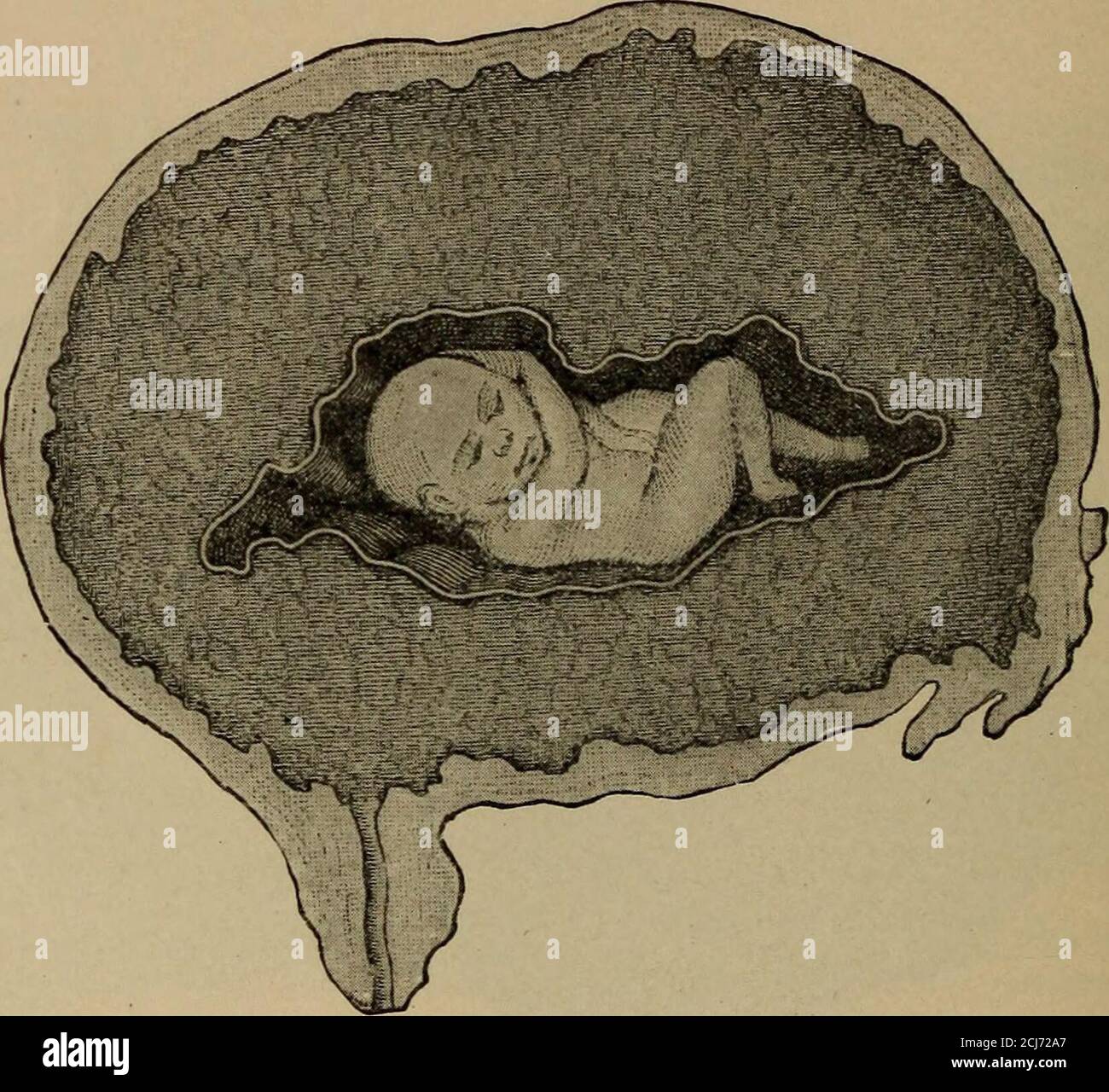 . The diagnosis of diseases of women . the life of the foetus.Rupture ...