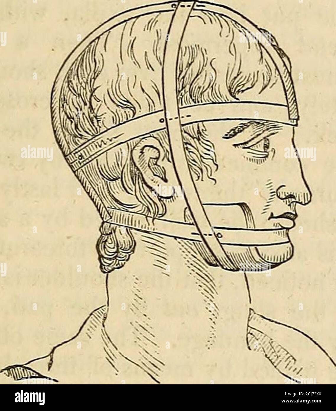 Fracture Forehead High Resolution Stock Photography and Images - Alamy