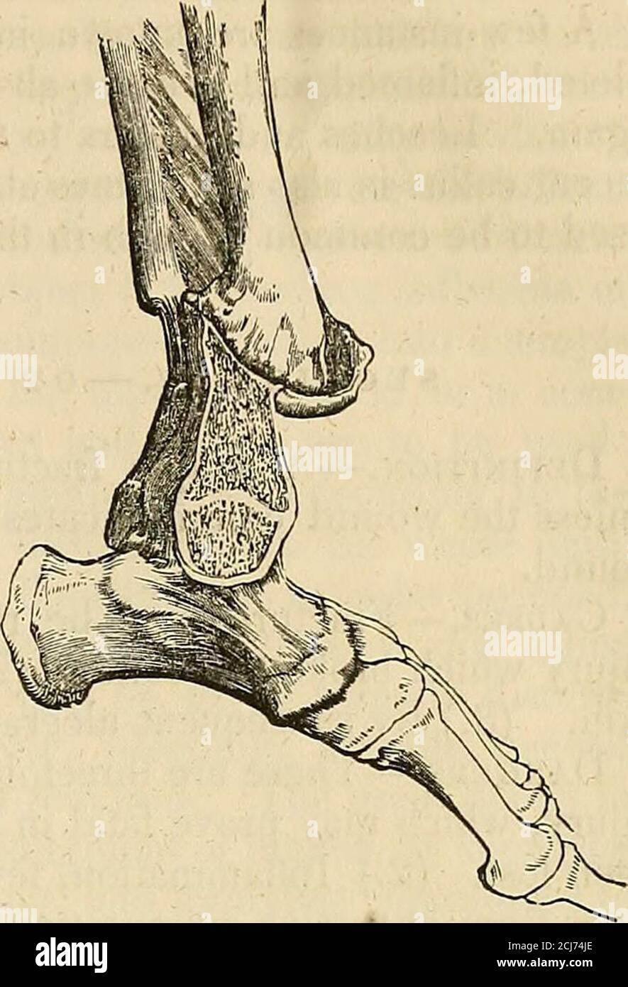 . The principles and practice of modern surgery . nite by bone. This is ...