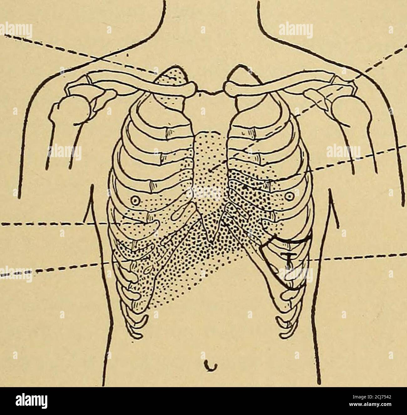 Percussion method hi-res stock photography and images - Alamy