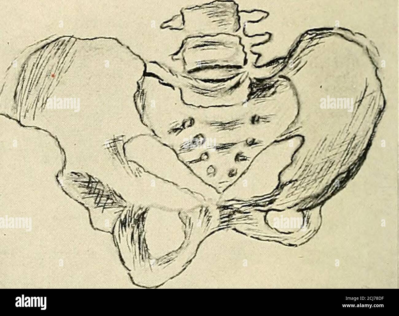 . American practice of surgery ; a complete system of the science and ...