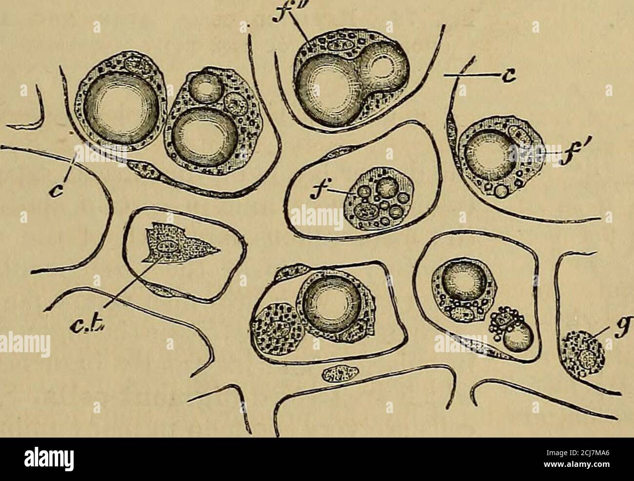 . Quain's elements of anatomy . Fig. 77. Deposition op fat in ...