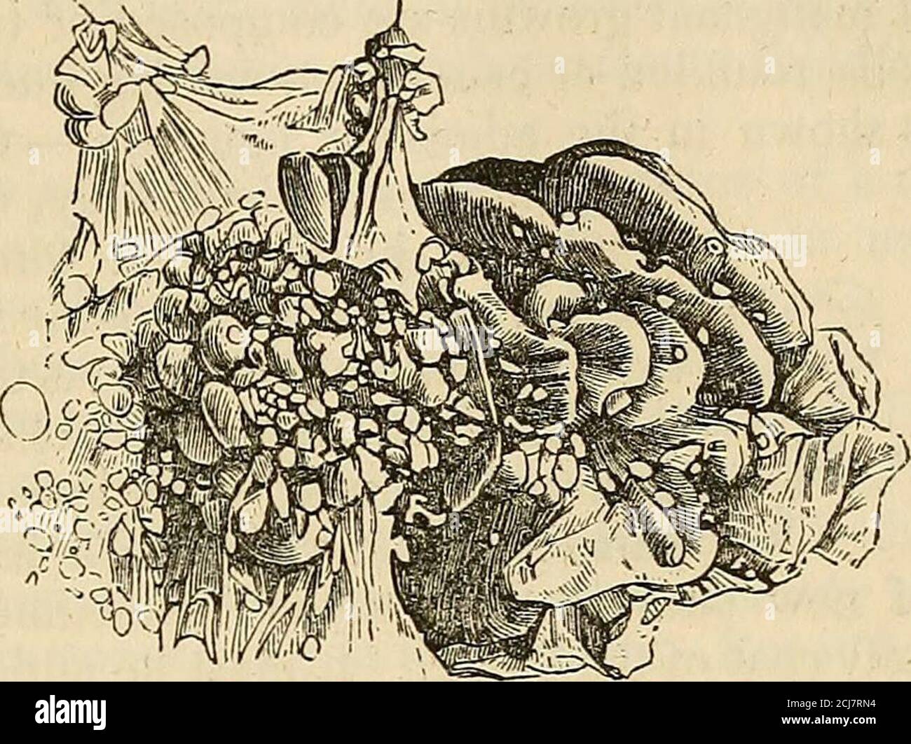 Costive hi-res stock photography and images - Alamy