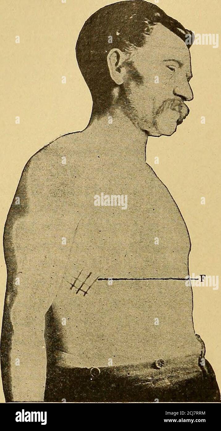 . Physical diagnosis . great impor-tance in diagnosis. These vari ...