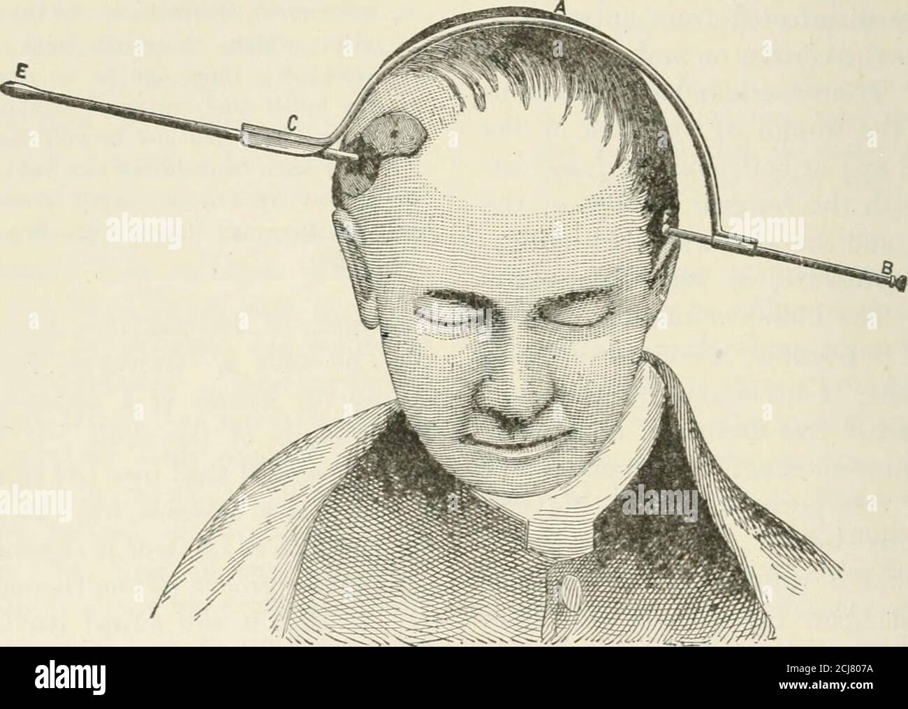Probing the brain hi-res stock photography and images - Alamy