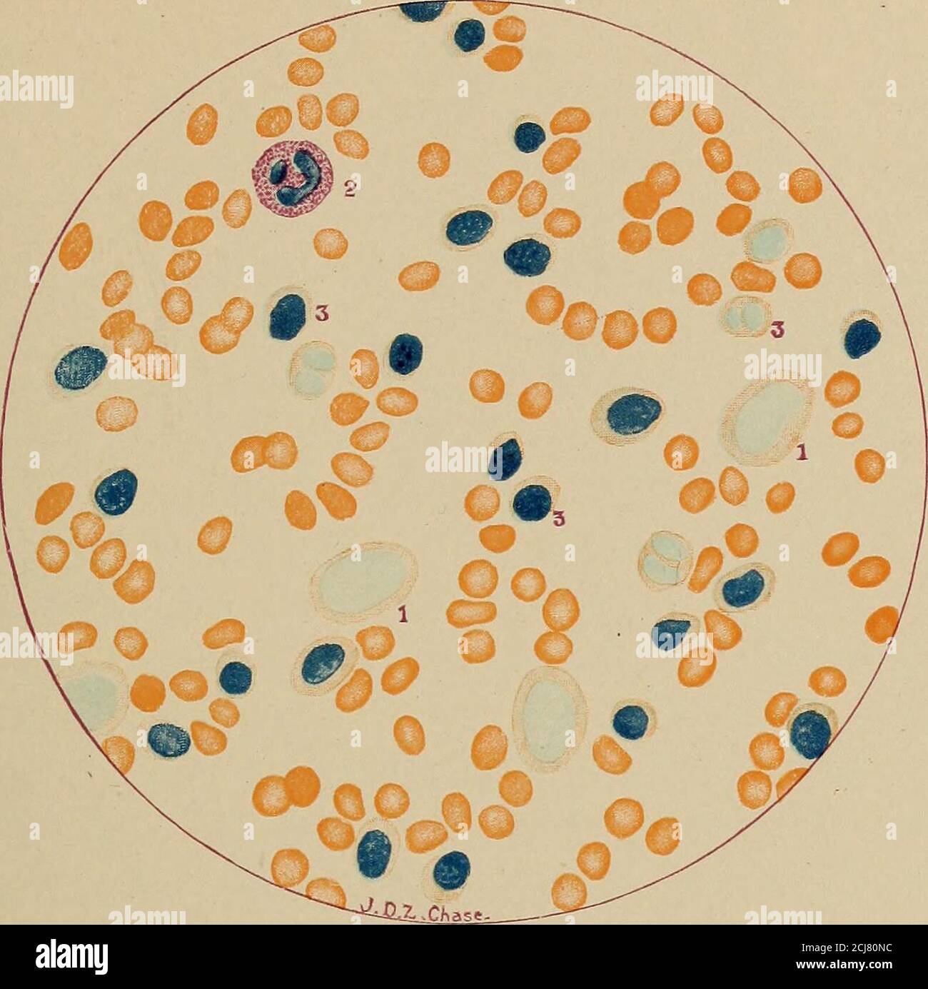 Leukocyt hi-res stock photography and images - Alamy