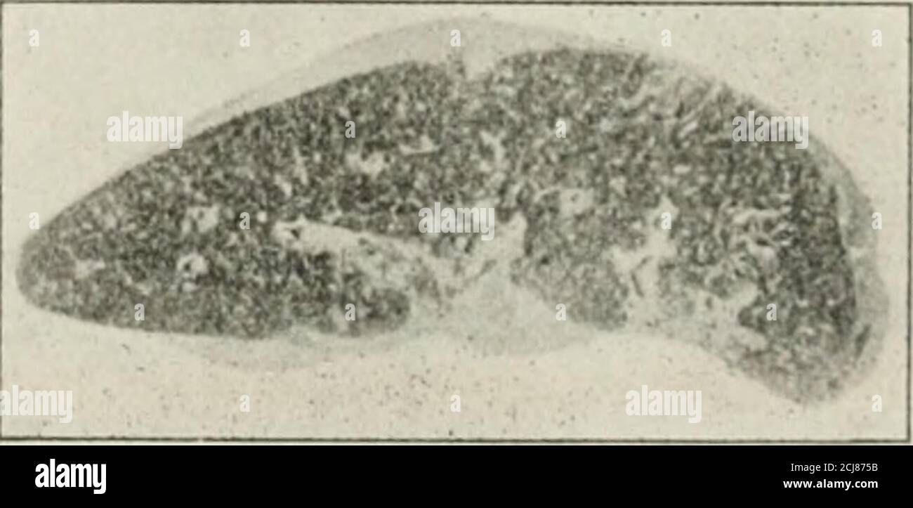 Arcus senilis hi-res stock photography and images - Alamy