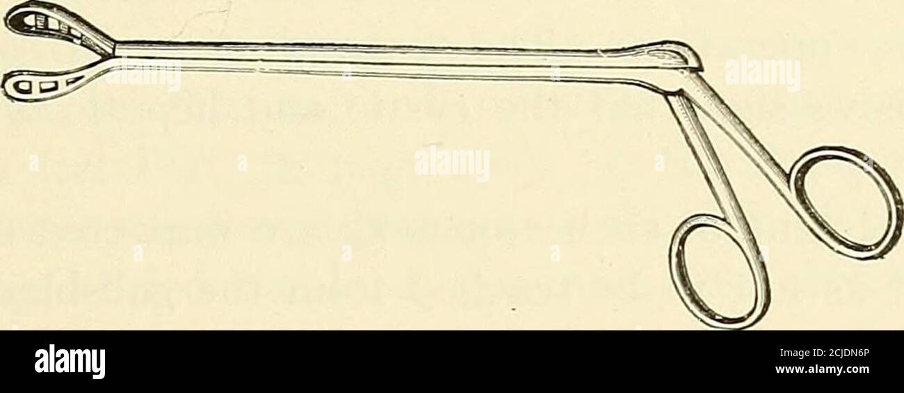 Finger gall hi-res stock photography and images - Alamy