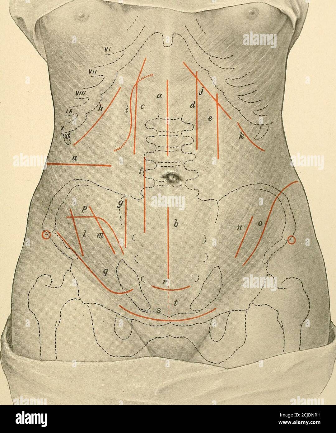 . American practice of surgery ; a complete system of the science and ...