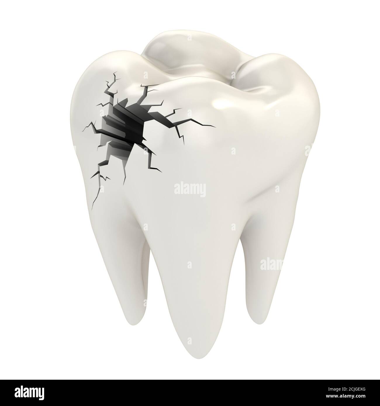 Broken tooth hi-res stock photography and images - Alamy