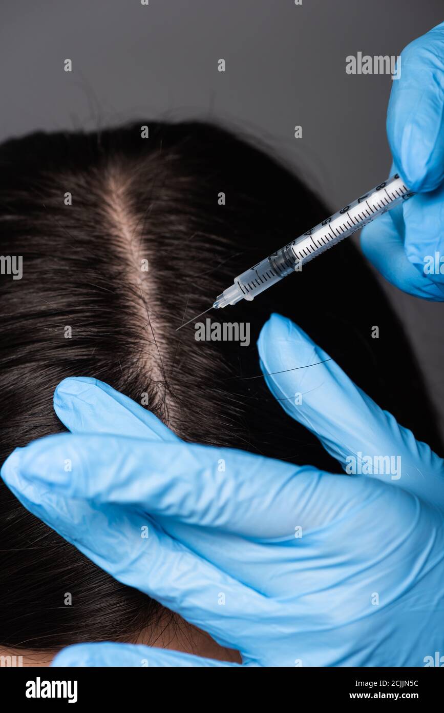 Mesotherapy hands hi-res stock photography and images - Alamy