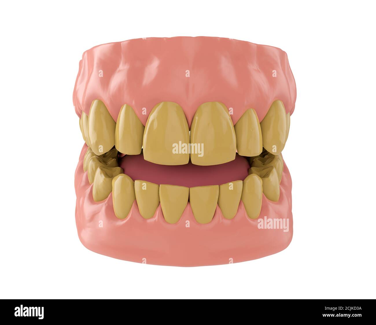 human Jaw with yellow teeth, 3d render Stock Photo - Alamy