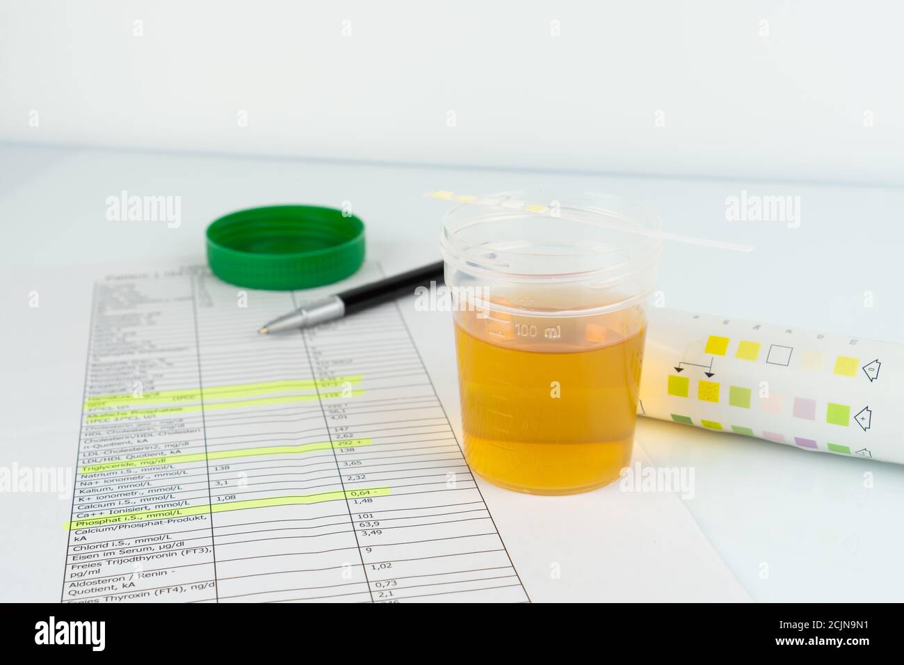 Closeup shot of routine urinalysis, reagent strip for urinalysis Stock ...
