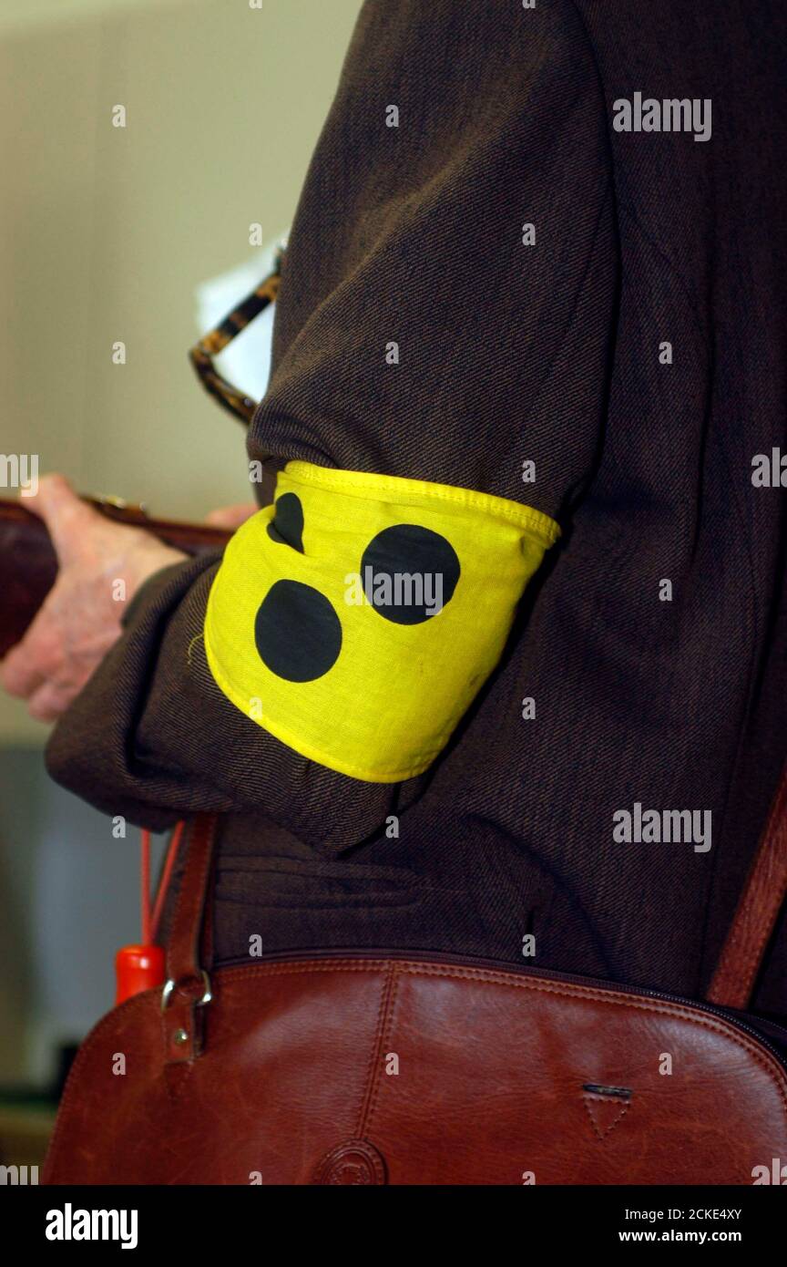 Blind loop with three black dots on a persons left arm Stock Photo - Alamy