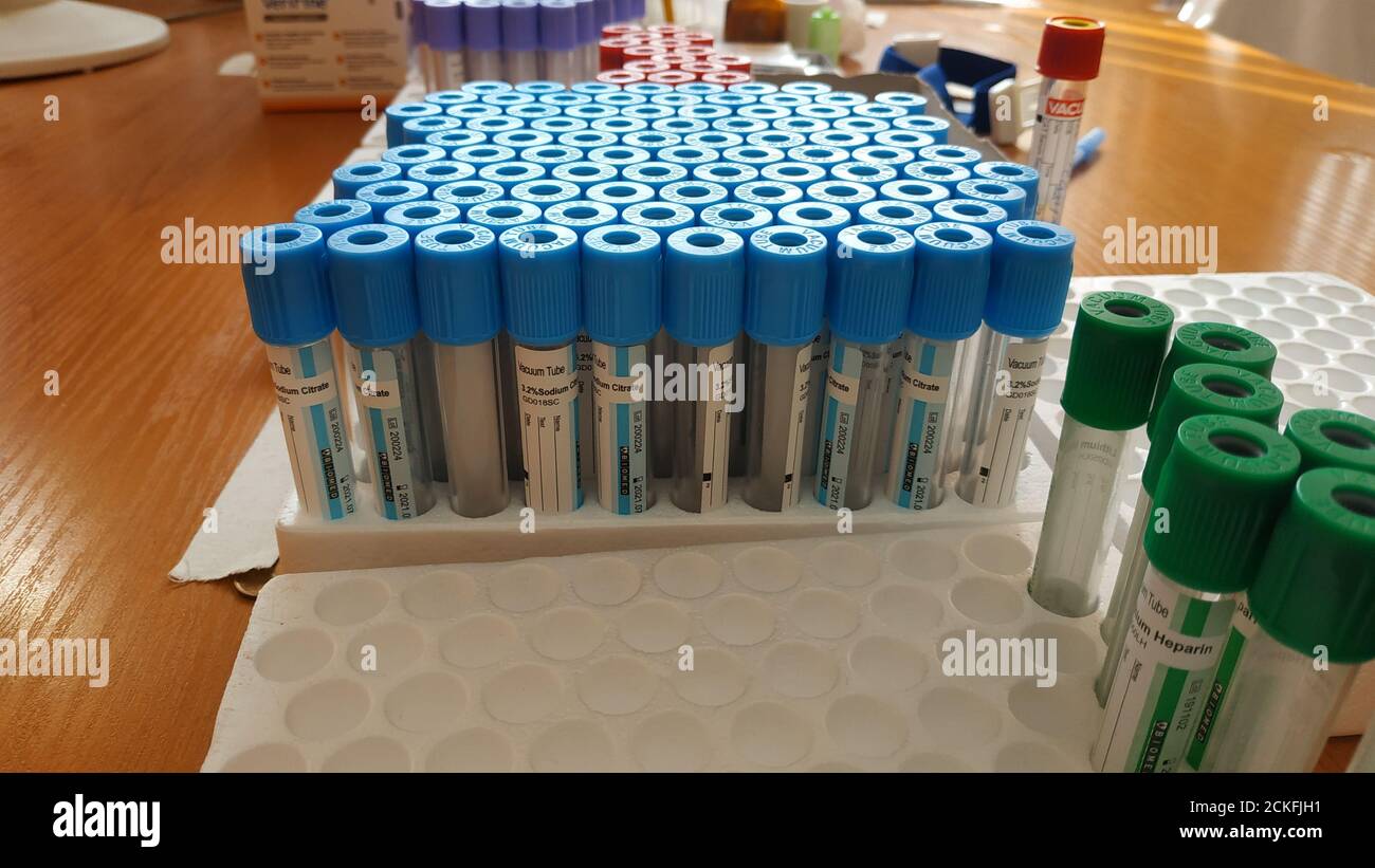 High angle shot of blood test containers in the laboratory Stock Photo ...