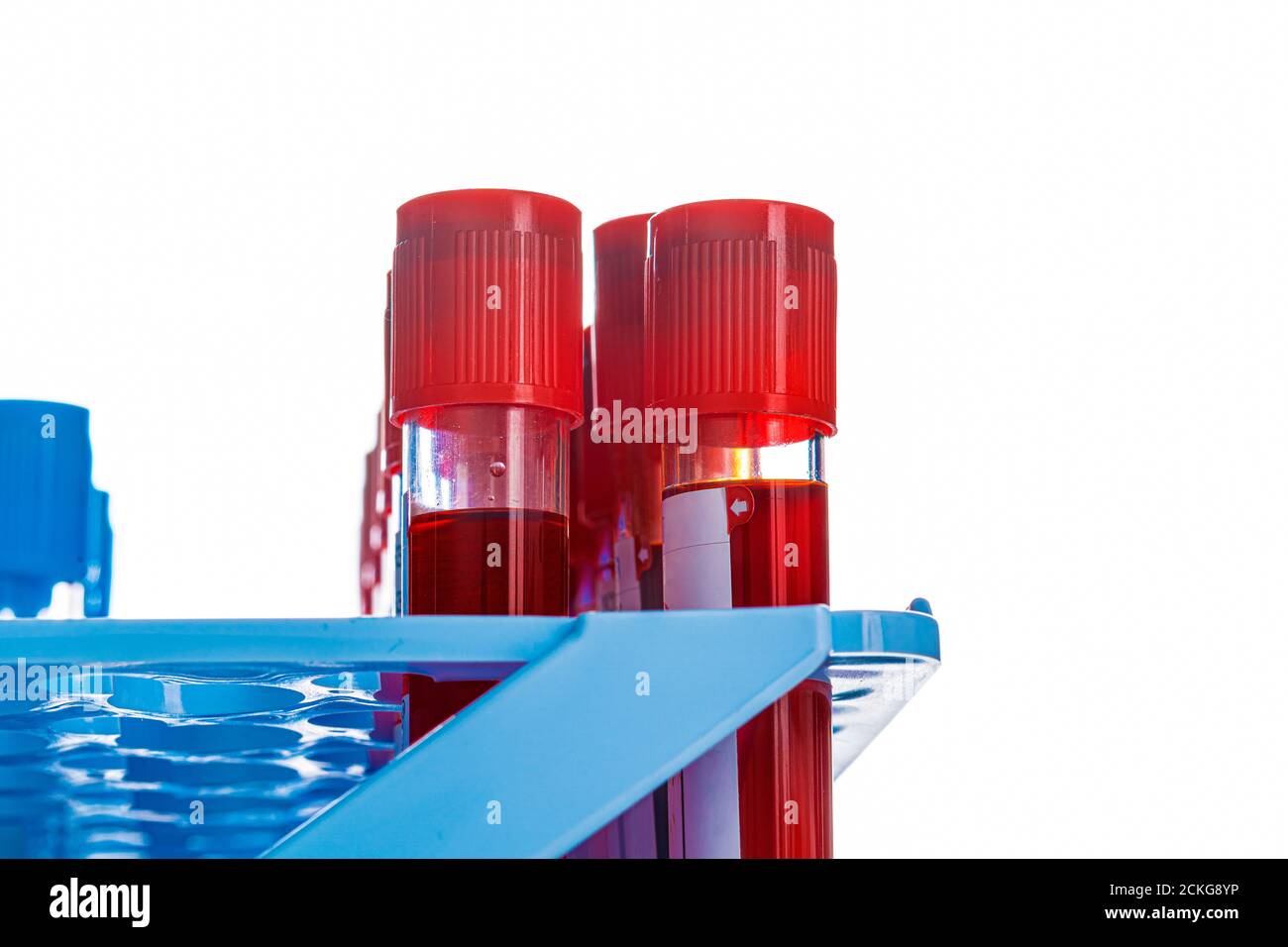 Close up of blood test tube with blood Stock Photo - Alamy