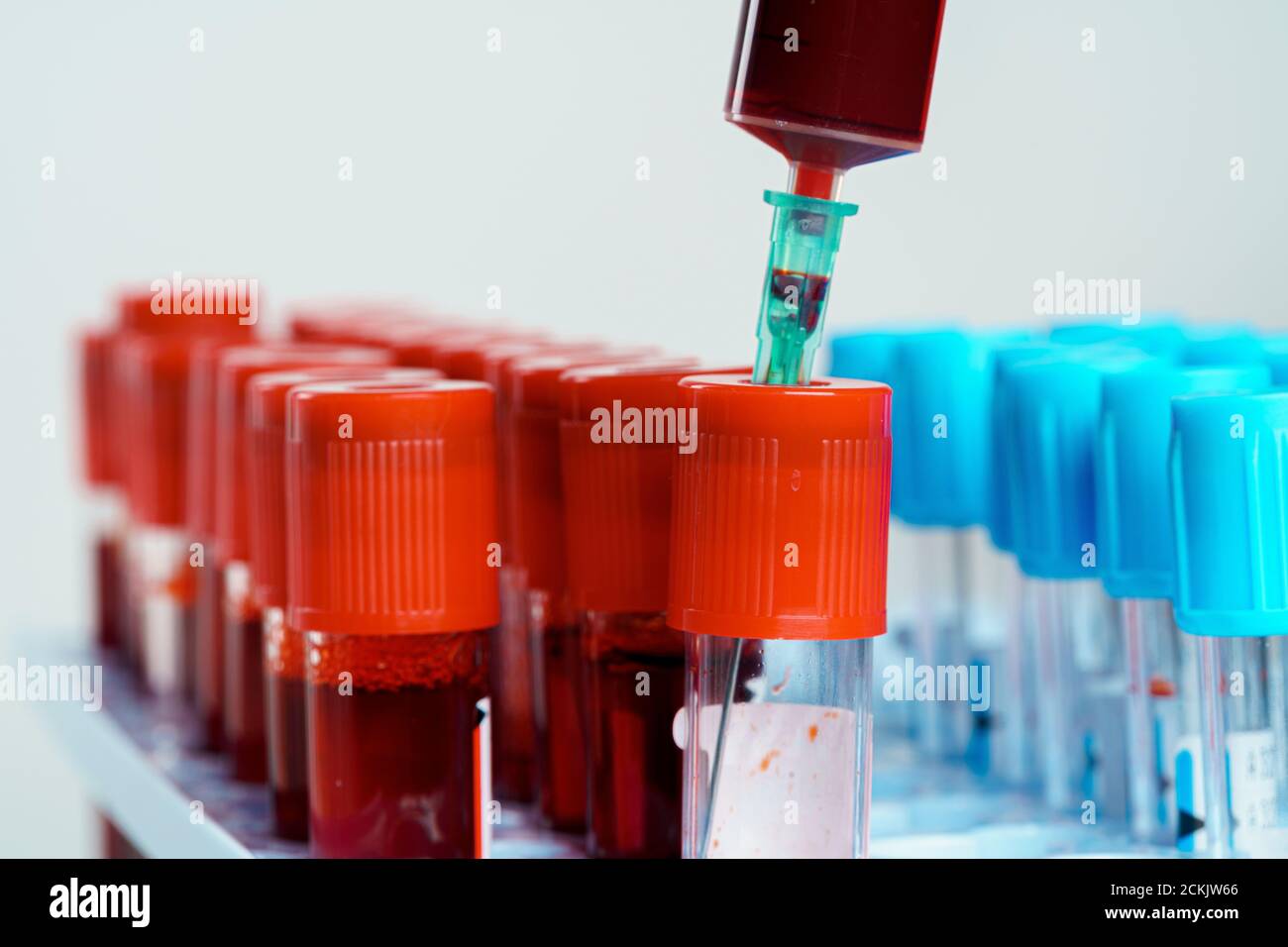 Blood sample tubes medical equipment close up Stock Photo - Alamy