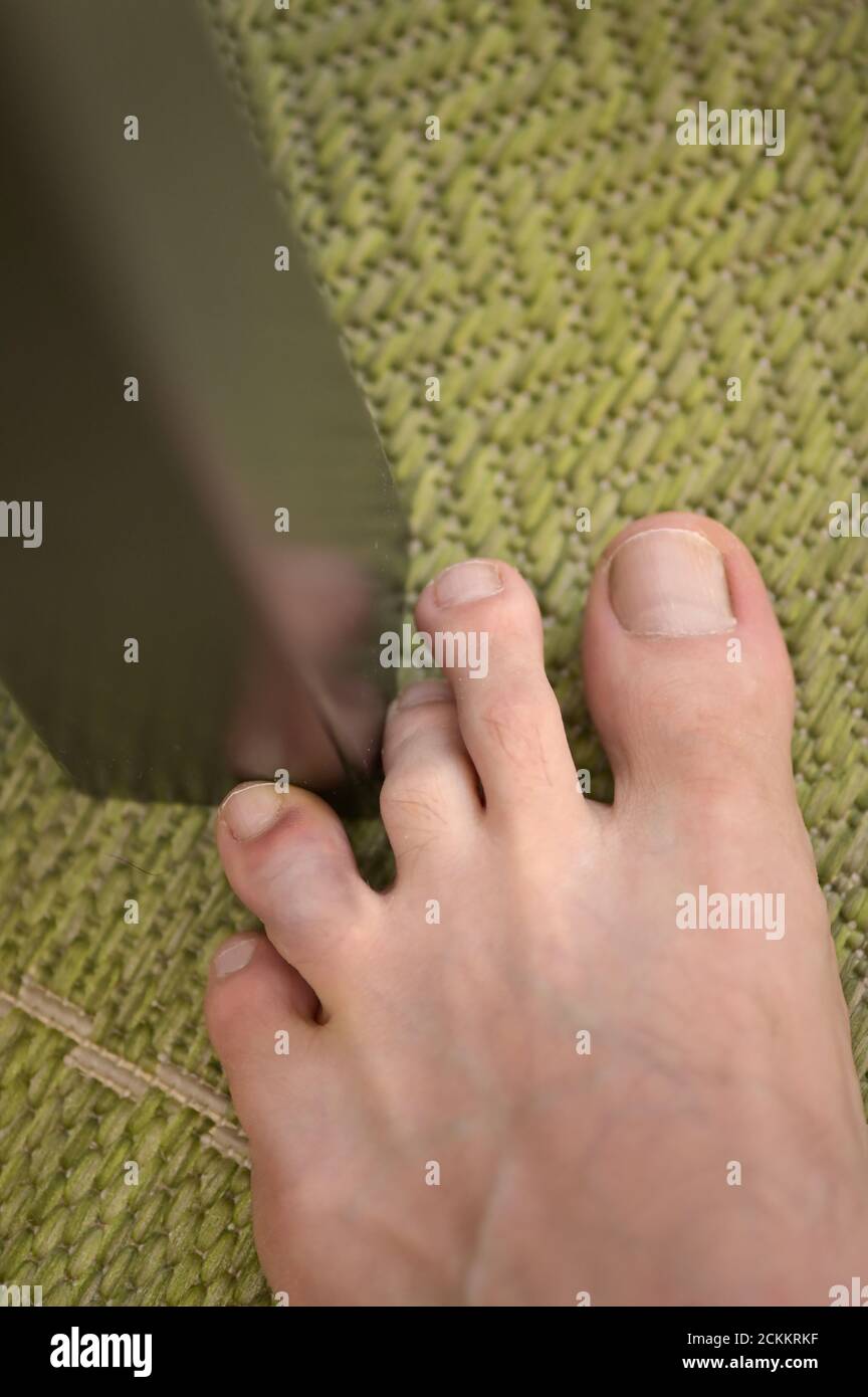 Finger man toe injured after kicking a table foot Stock Photo - Alamy